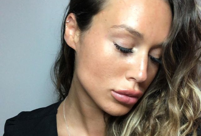 Toxins, Knoxville, TN | Jessica Ellam Aesthetics