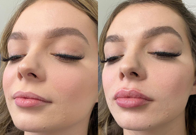 Brows, Knoxville, TN | Jessica Ellam Aesthetics