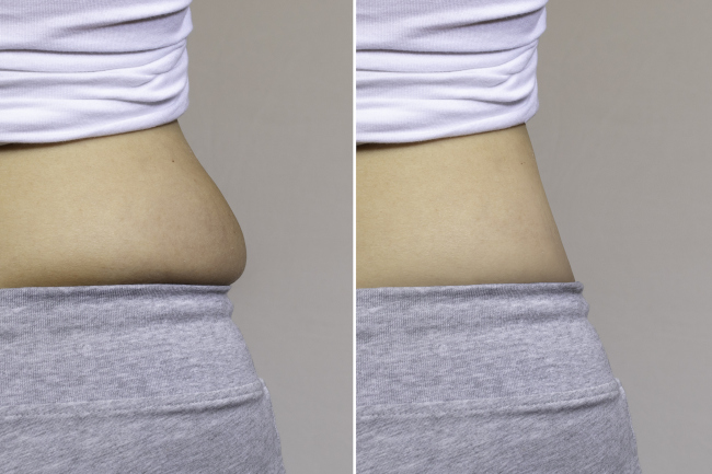 Physiq Body Contour, Knoxville | Jessica Ellam Aesthetics