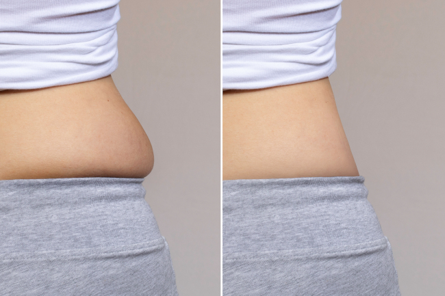 Body Treatments, Knoxville, TN | Jessica Ellam Aesthetics